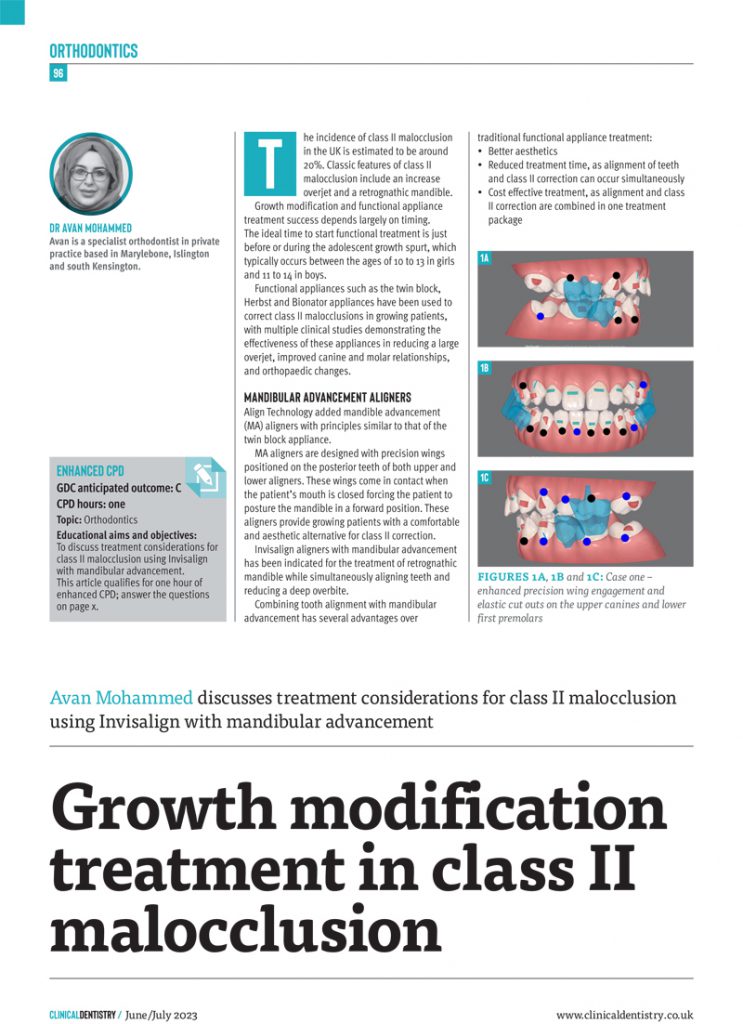 Growth modification treatment in class II malocclusion | Queens Gate ...