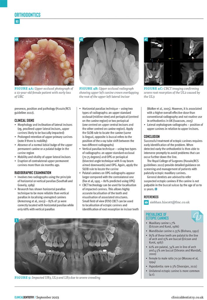 Understanding Ectopic Canines | Queens Gate Orthodontics